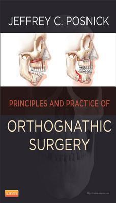 Orthognathic Surgery: Principles and Practice by Jeffrey C. Posnick ...