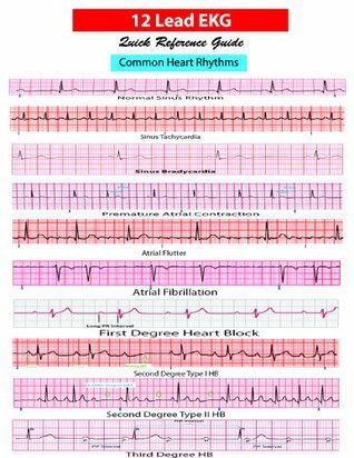 12 Lead EKG Pocket Card by APRN World | Goodreads