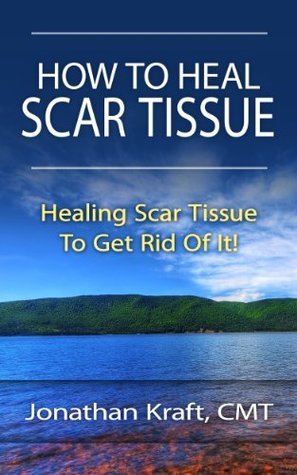 How to Heal Scar Tissue: How To Heal Your Own Scar Tissue And Get Rid ...