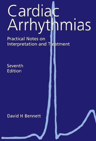 Cardiac Arrhythmias : Practical Notes on Interpretation and Treatment ...