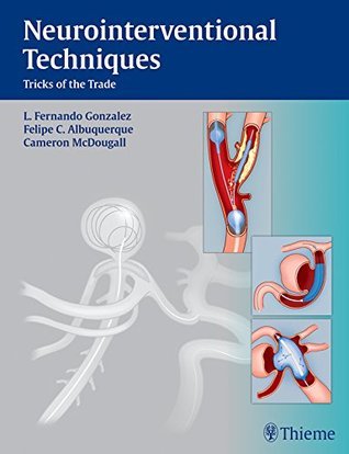 Neurointerventional Techniques: Tricks of the Trade by Fernando L ...