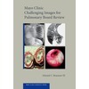 Mayo Clinic Challenging Images for Pulmonary Board Review by Edward C ...