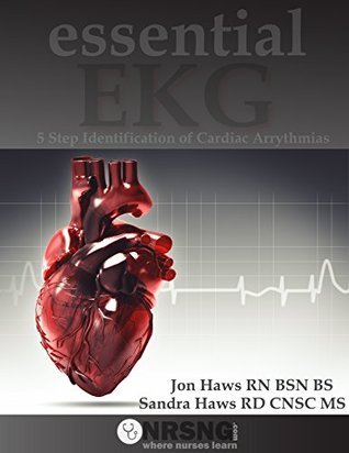 Essential EKG: EKG Interpretation, Rhythms, Arrhythmia, Basic Cardiac Dysrhythmias by Jon Haws ...