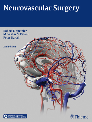 Neurovascular Surgery by Robert F. Spetzler | Goodreads