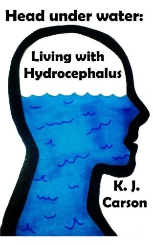 Head under water: Living with Hydrocephalus by K.J. Carson | Goodreads