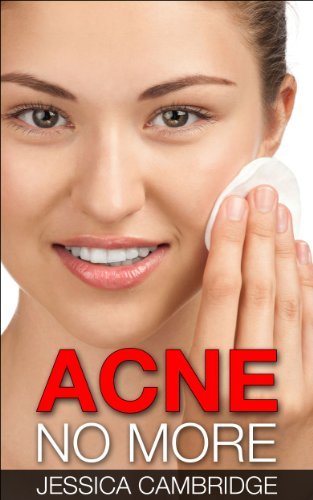 Acne No More: The Secret Of Living An Acne Free Life, A Guide To Acne ...