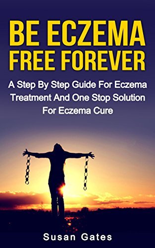 Eczema Free Forever: A Step By Step Guide For Eczema Treatment And A ...