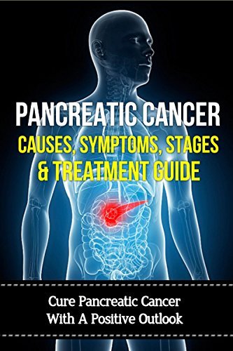 Pancreatic Cancer Causes, Symptoms, Stages & Treatment Guide: Cure ...