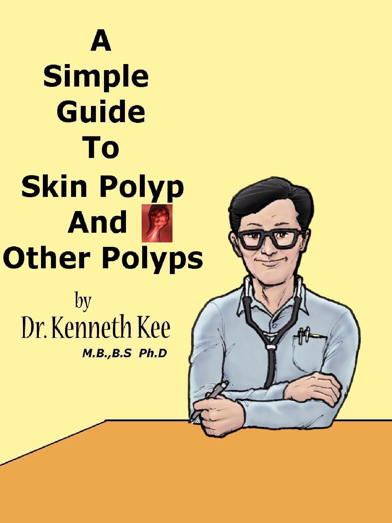 A Simple Guide to Skin Polyp and Other Polyps by Kenneth Kee | Goodreads
