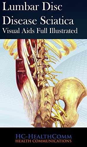 Lumbar disc disease sciatica: Visual Aids Full Illustrated by HC ...