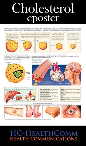Cholesterol eposter: Understanding, Treating and Preventing Cholesterol ...