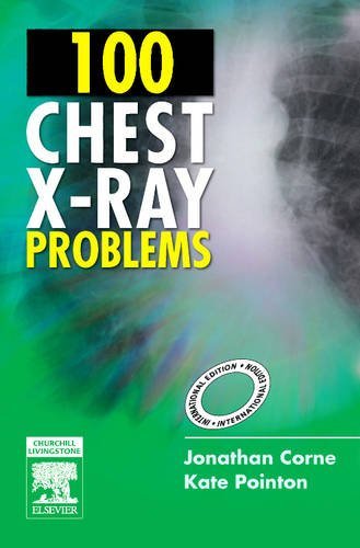 100 Chest X-Ray Problems, International Edition by Corne | Goodreads