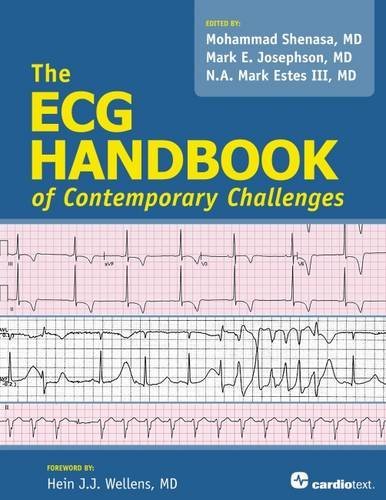 The ECG Handbook of Contemporary Challenges by Mohammad Shenasa | Goodreads