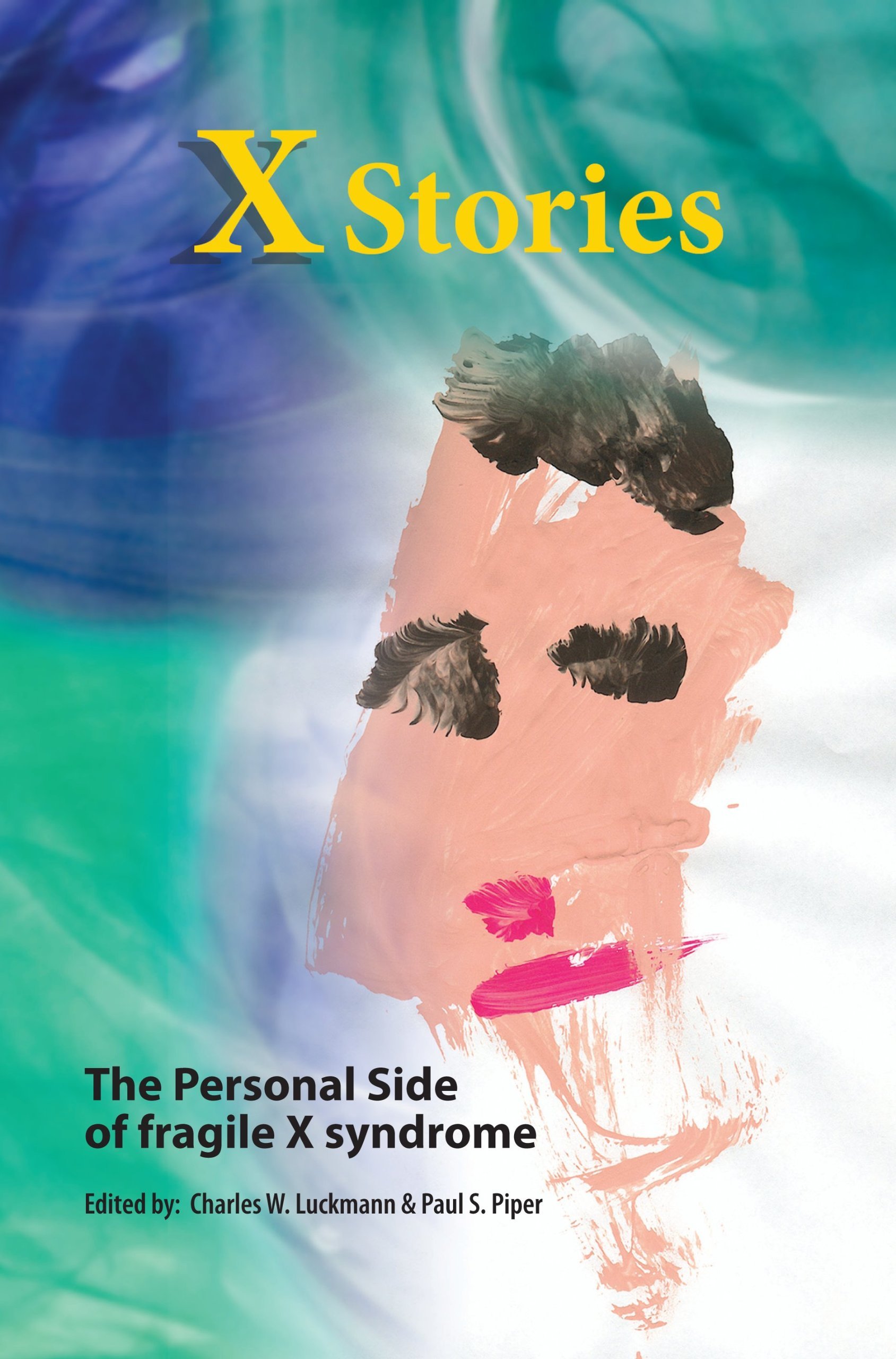 X Stories: The Personal Side of Fragile X Syndrome by Charles W ...