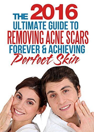 The Ultimate Guide to Removing Acne Scars Forever and Achieving Perfect ...
