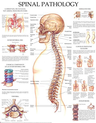 Spinal Pathology - Quick Reference Chart: Full illustrated by HC-HealthComm | Goodreads
