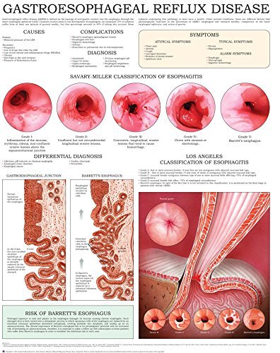 Gastroesophageal reflux disease e-chart: Quick reference guide by HC ...