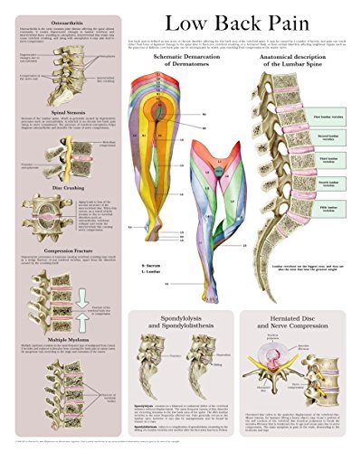 Low Back Pain e-chart: Quick reference guide by HC-HealthComm | Goodreads