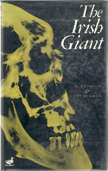 The Irish Giant by G. Frankcom | Goodreads