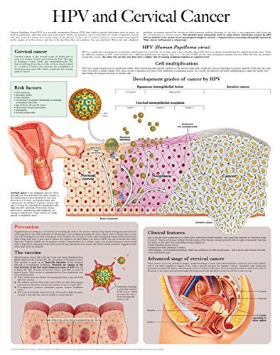 HPV and Cervical Cancer e-chart: Full illustrated by HC-HealthComm ...
