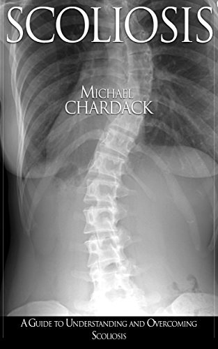 Scoliosis: A Guide to Understanding and Overcoming Scoliosis by Michael ...