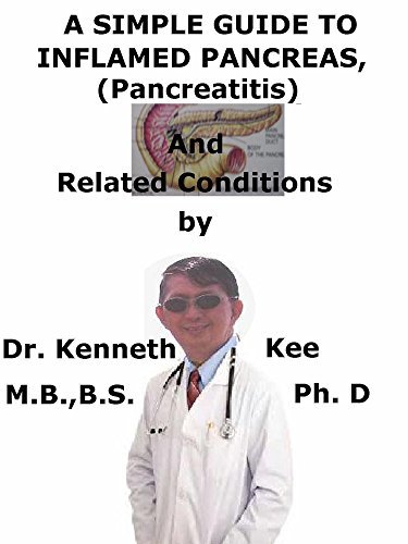 A Simple Guide To Inflamed Pancreas (Pancreatitis), Diagnosis ...