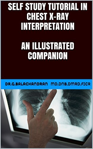 SELF STUDY TUTORIAL IN CHEST X-RAY INTERPRETATION AN ILLUSTRATED ...