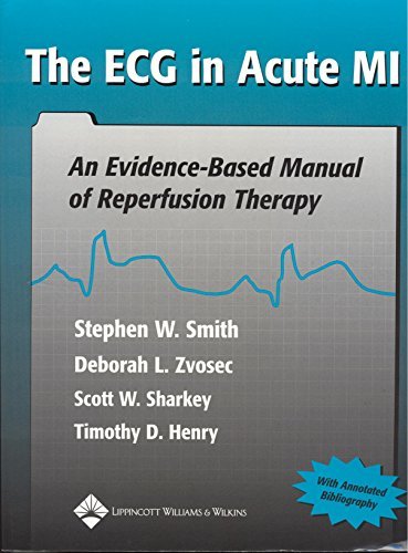 The ECG in Acute MI: An Evidence-Based Manual of Reperfusion Therapy by ...