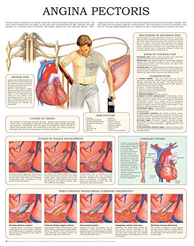 Angina pectoris e-chart: Quick reference guide by HC-HealthComm | Goodreads