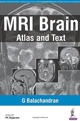 MRI Brain: Atlas and Text by G. Balachandran | Goodreads
