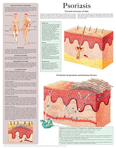 Psoriasis e-chart: Full illustrated by HC-HealthComm | Goodreads