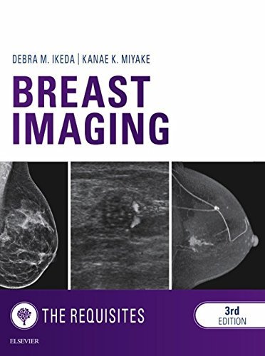 Breast Imaging: The Requisites E-Book by Debra Ikeda | Goodreads