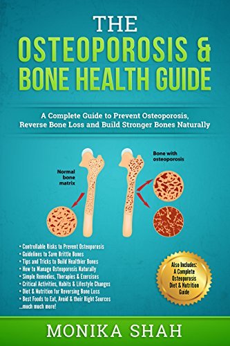 Osteoporosis: The Osteoporosis & Bone Health Guide: A Complete Guide to ...