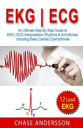 EKG | ECG: An Ultimate Step-By-Step Guide to 12-Lead EKG | ECG Interpretation, Rhythms ...