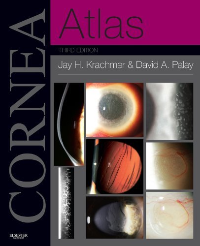 Cornea Atlas: Cornea Atlas E-Book (Expert Consult) by Jay H. Krachmer ...