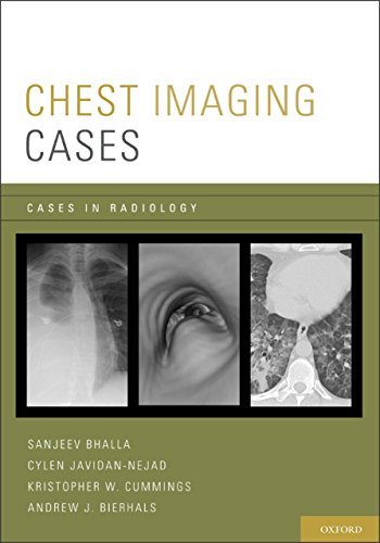 Chest Imaging Cases (Cases in Radiology) by Sanjeev Bhalla | Goodreads