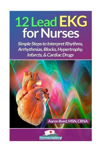 12 Lead EKG for Nurses: Simple Steps to Interpret Rhythms, Arrhythmias ...