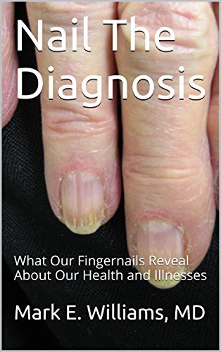 Nail the Diagnosis: What Our Fingernails Reveal About Our Health and ...