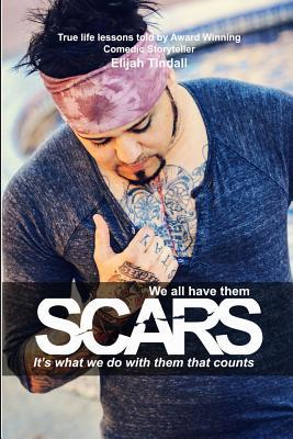 Scars: We all have them, it's what we do with them that counts by ...