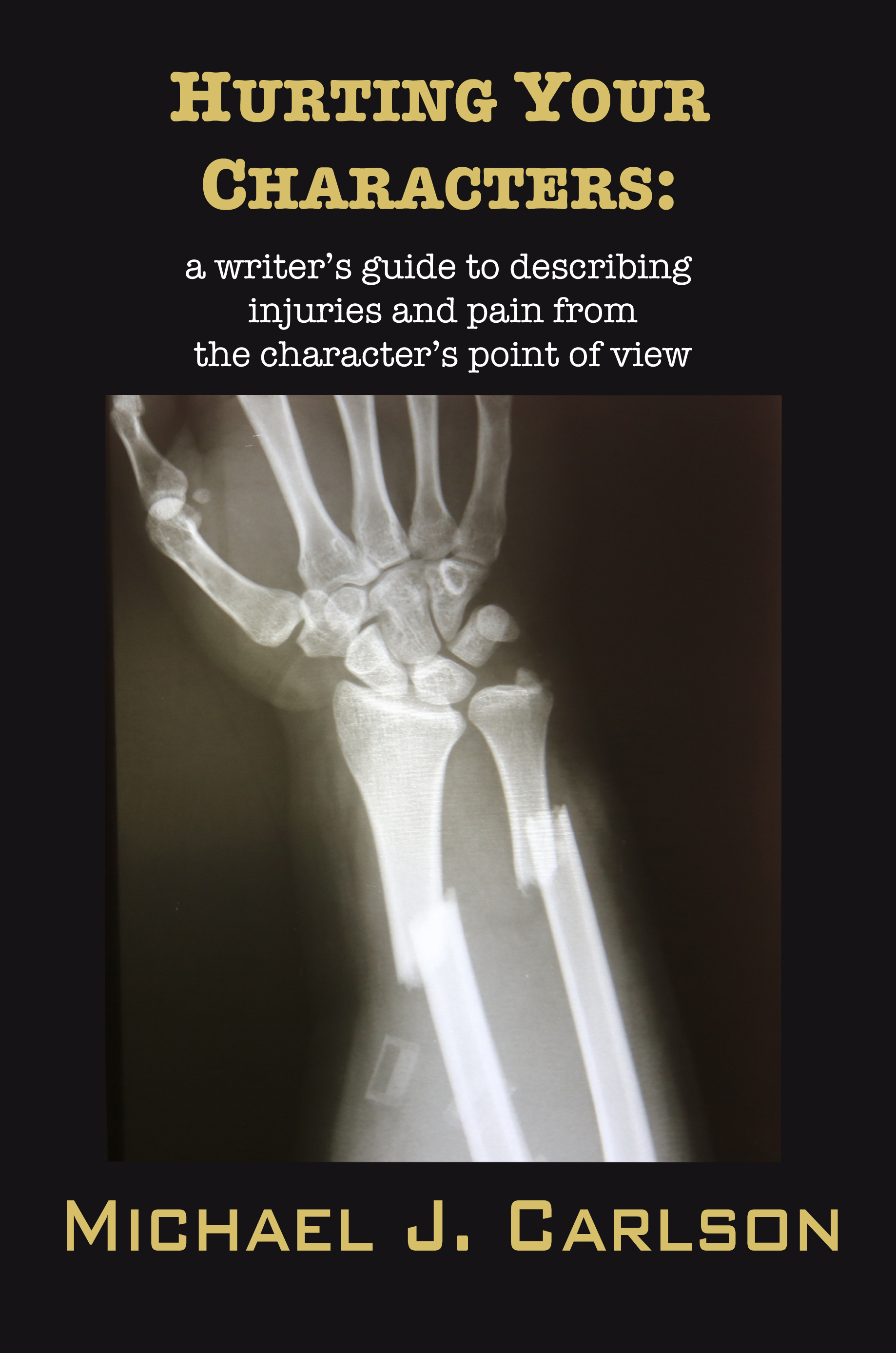 Hurting Your Characters: A Writer's Guide to Describing Injuries and ...