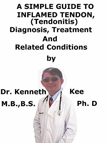 A Simple Guide To Inflamed Tendons (Tendonitis) Diagnosis, Treatment ...