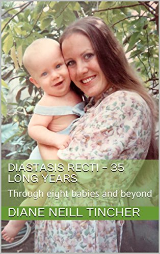 Diastasis Recti - 35 Long Years: Through eight babies and beyond by ...