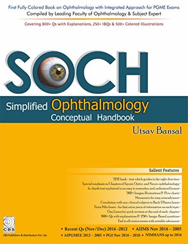 Soch Simplified Ophthalmology Conceptual Handbook (Pb-2017) by Bansal ...