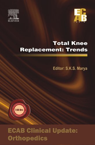 Total Knee Replacement Trends Ecab By Marya Goodreads