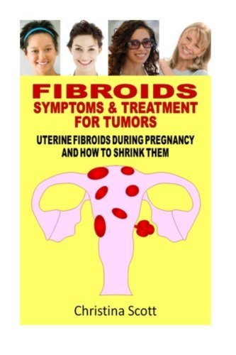 Fibroids : Symptoms & Treatment For Tumors: Uterine Fibroids During ...