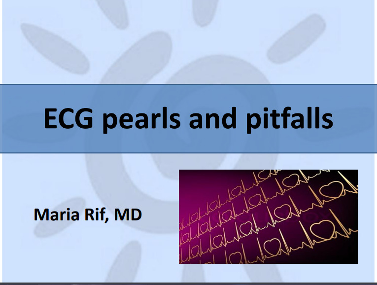 ECG pearls and pitfalls by Maria Rif | Goodreads
