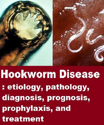 Hookworm Disease : etiology, pathology, diagnosis, prognosis ...