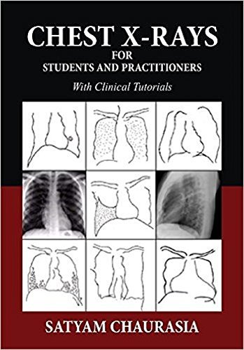 Chest X-Rays for students and practitioners: with clinical tutorials by ...