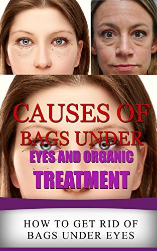 Causes of Bags Under Eyes and Organic Treatment: How to Get Rid of Bags ...