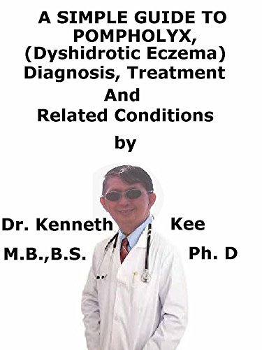 A Simple Guide To Pompholyx, (Dyshidrotic Ezcema) Diagnosis, Treatment ...